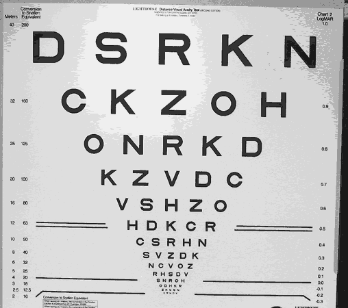 Volume 1 Chapter 46 Vision Rehabilitation