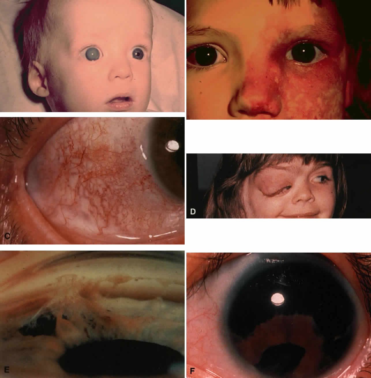 Volume 3 Chapter 49 Visual Fields In Glaucoma